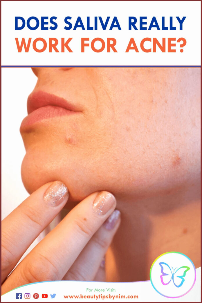 Saliva for Acne? Does Saliva Really Work? - Beauty Tips By Nim